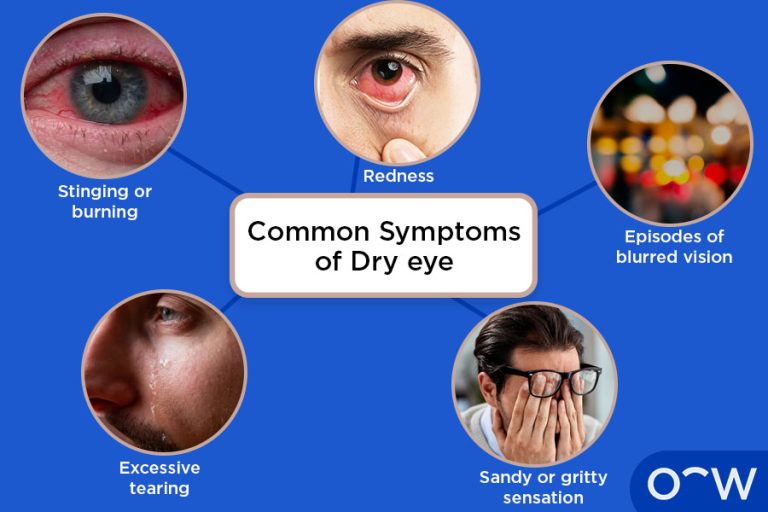 DRY EYES WHAT YOU NEED TO KNOW - SYARIKAT CERMIN MATA STARLITE